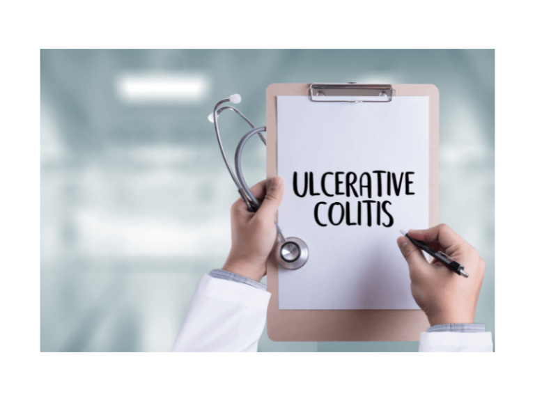 Signs of Ulcerative Colitis Remission | Ulcerative Colitis Remission
